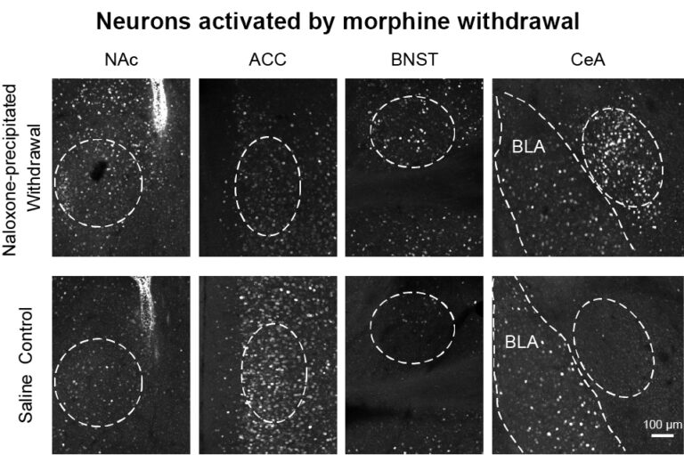 Circuits of Addiction - The Wang Lab at MIT