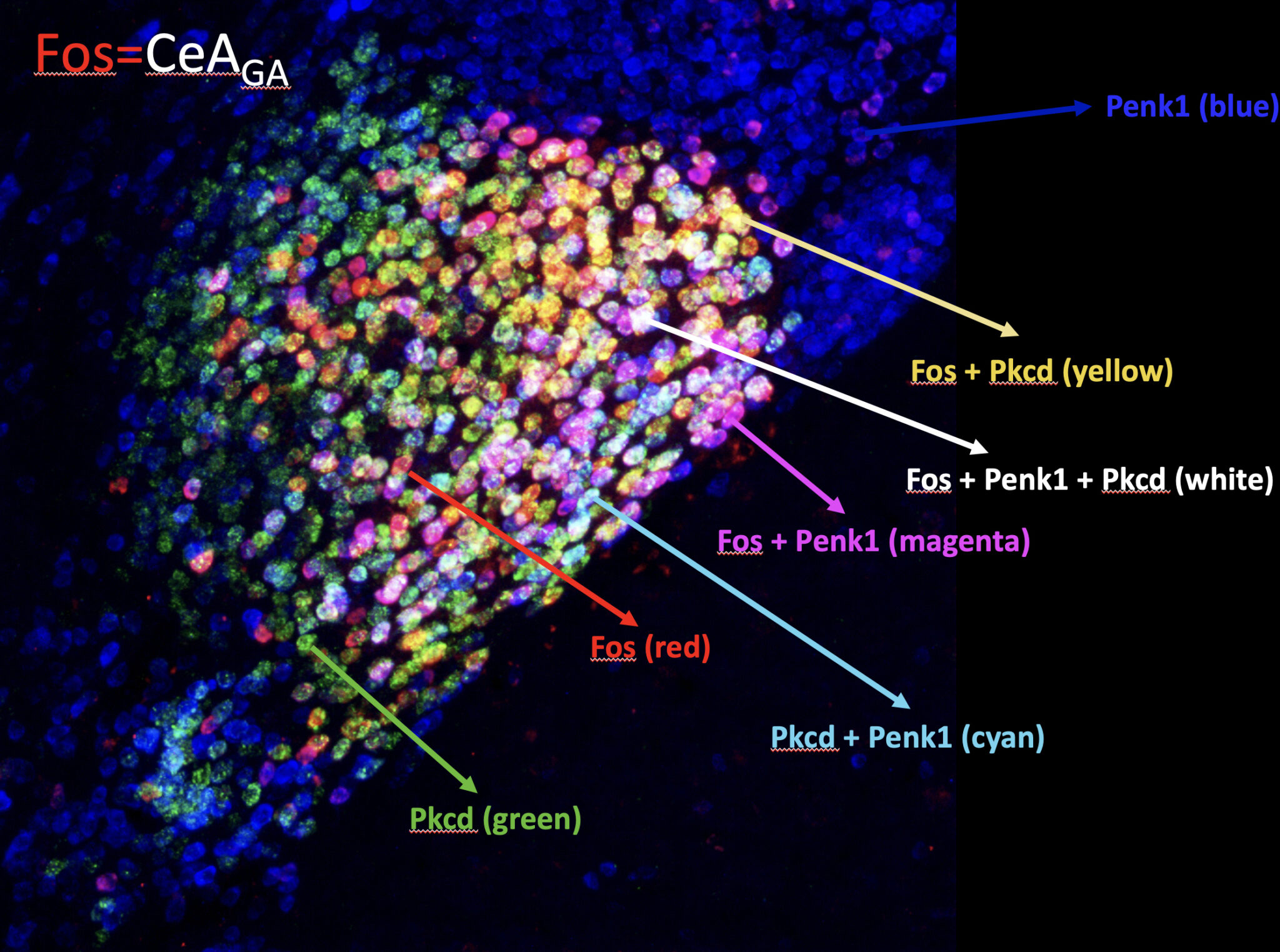 Pain and Anesthesia - The Wang Lab at MIT